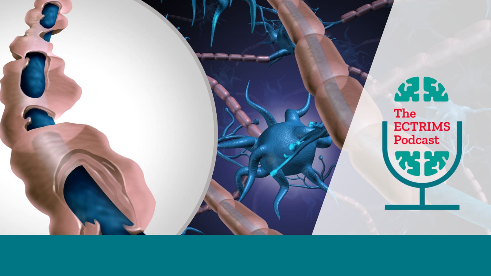 Episode 10: Remyelination in MS: a New Clinical Trial | ECTRIMS