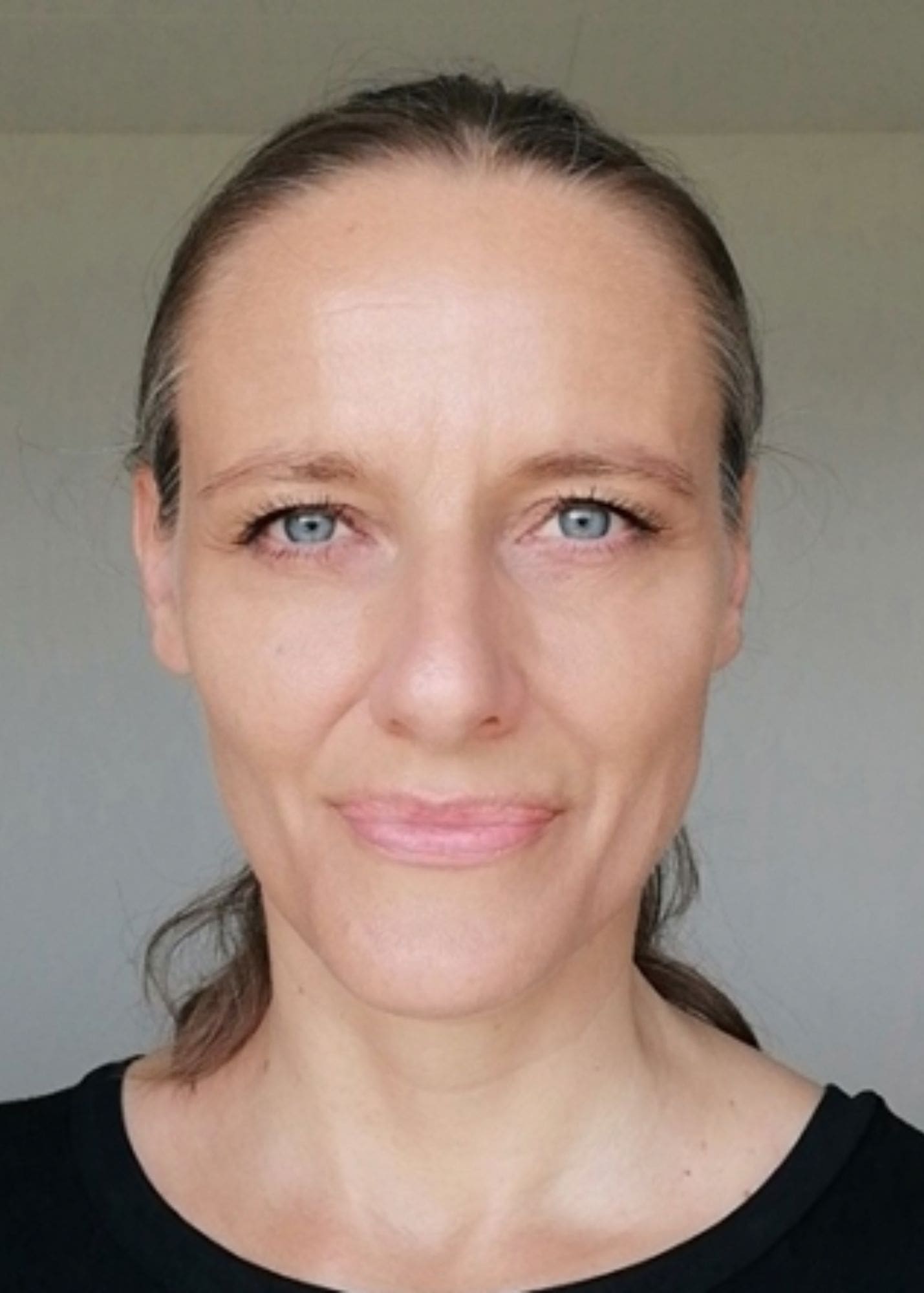 Meet the MSMilan2023 Poster Award Winners | ECTRIMS