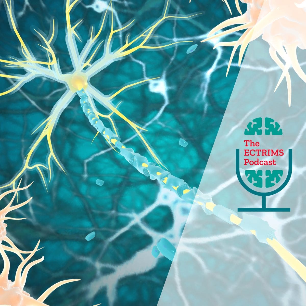 Episode 33: Myelin Plasticity and Repair | ECTRIMS